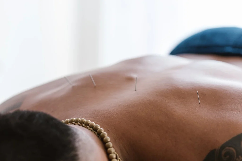 Acupuncture Massage Therapy in Montana | Adaptive Performance Center